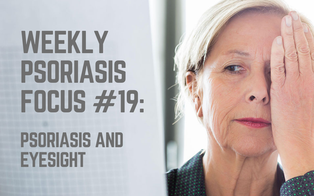 Psoriasis and Eyesight - Psoriasis Treatments