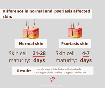 Picking psoriasis scales - Psoriasis Treatments